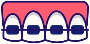 27 Ideas GENIALES para combinar colores de brackets | TodoSobreColores